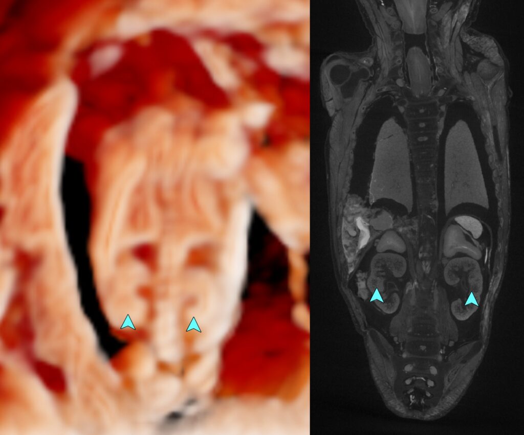 15 Weeks Gestation - 3D Human Development
