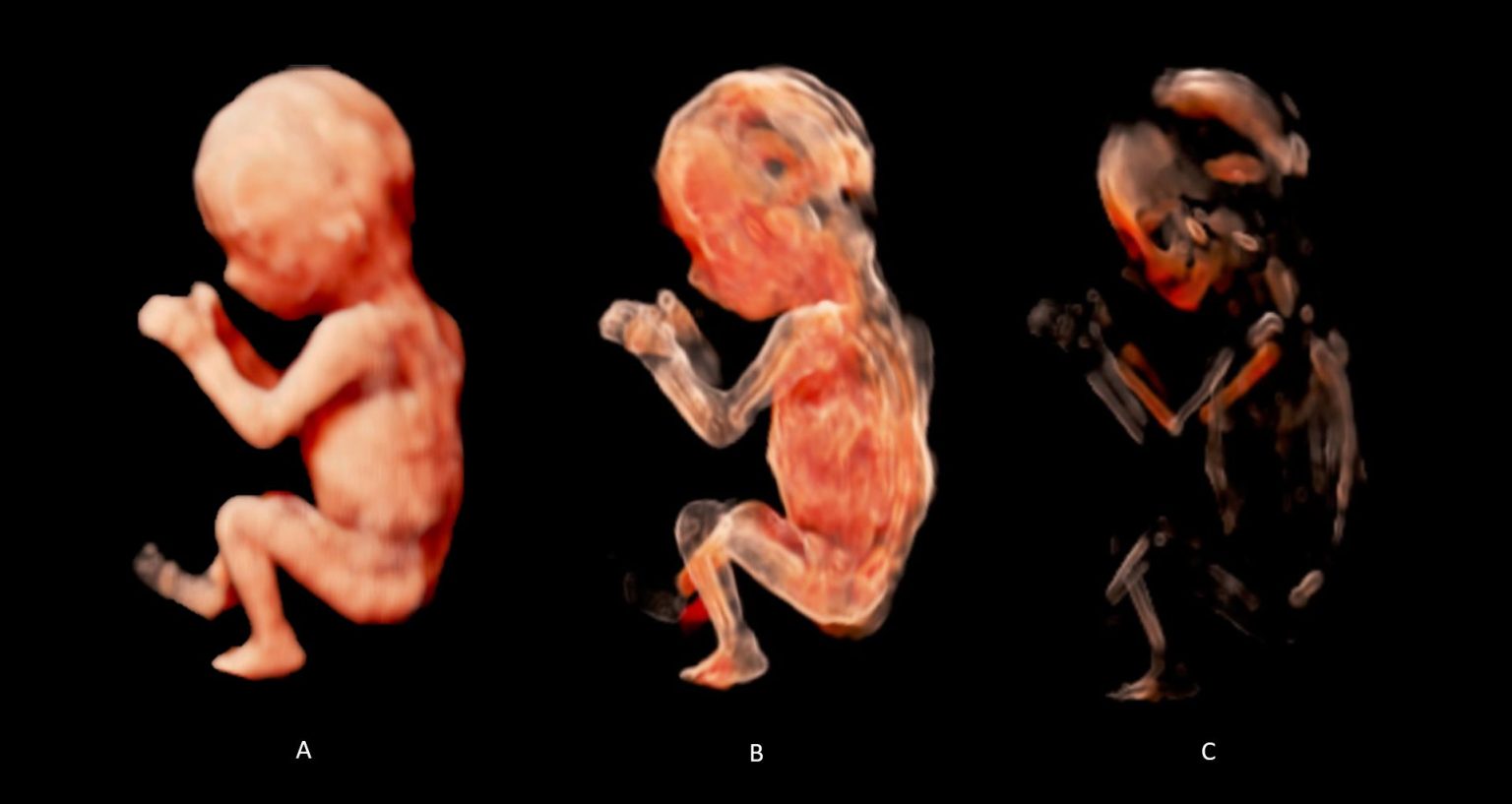 16 Weeks Gestation - 3D Human Development
