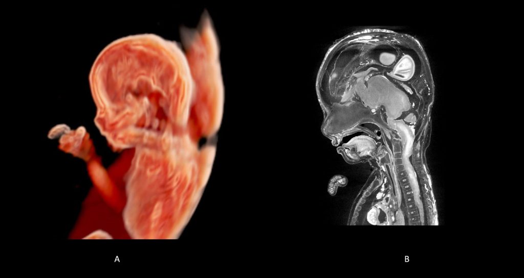 19 Weeks Gestation - 3D Human Development