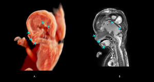 16 Weeks Gestation - 3D Human Development