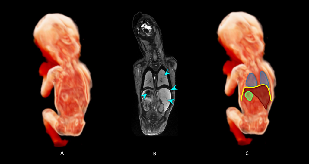 16 Weeks Gestation - 3D Human Development