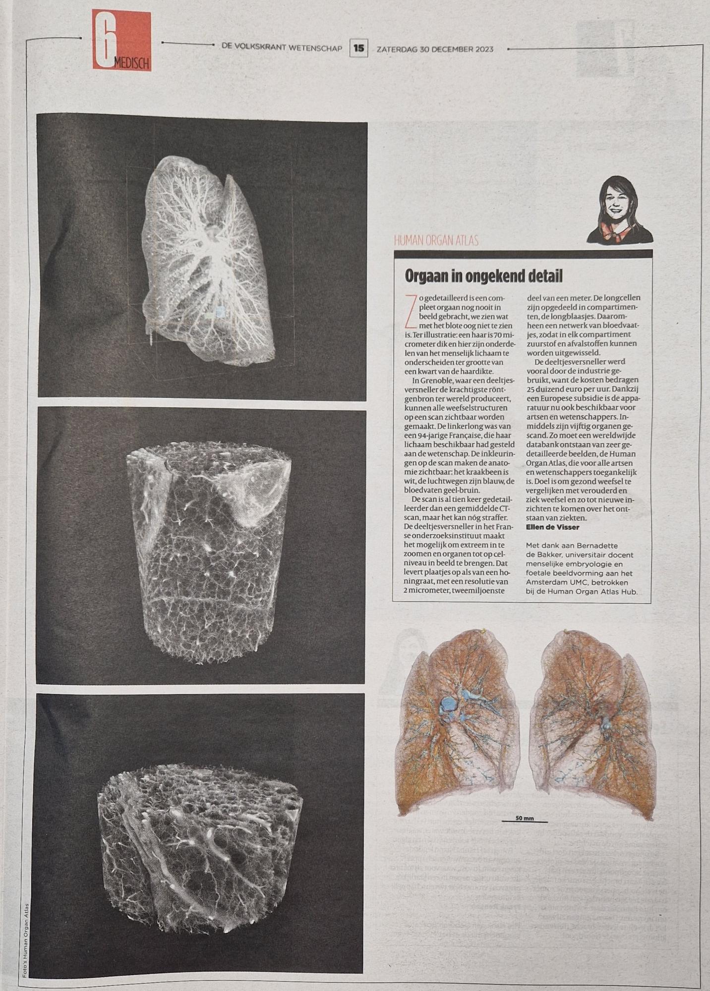 Outreach in 5 of the biggest Dutch Newspapers! - 3D Human Development