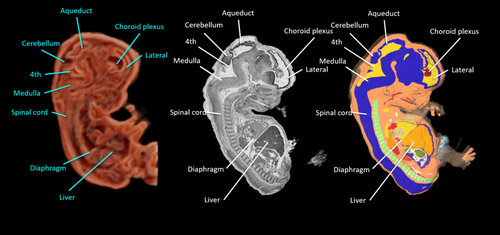 11 Weeks Gestation - 3D Human Development