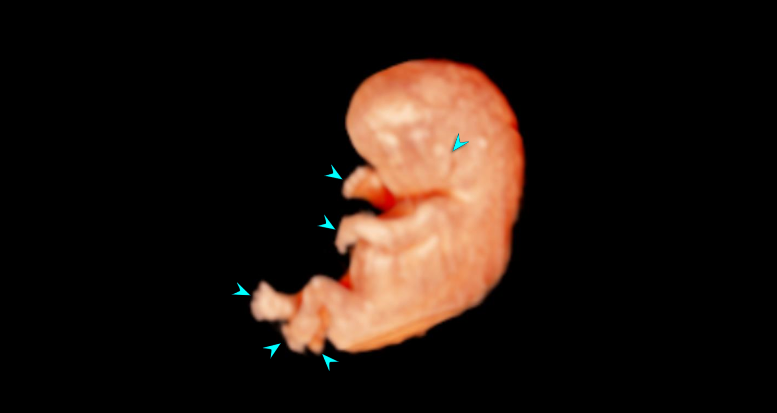 9 Weeks Gestation - 3D Human Development