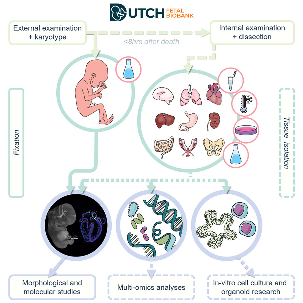 Dutch Fetal Biobank White paper published in Developmental Cell - 3D ...