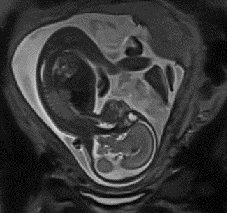 Review Imaging Fetal Anatomy - 3D Human Development