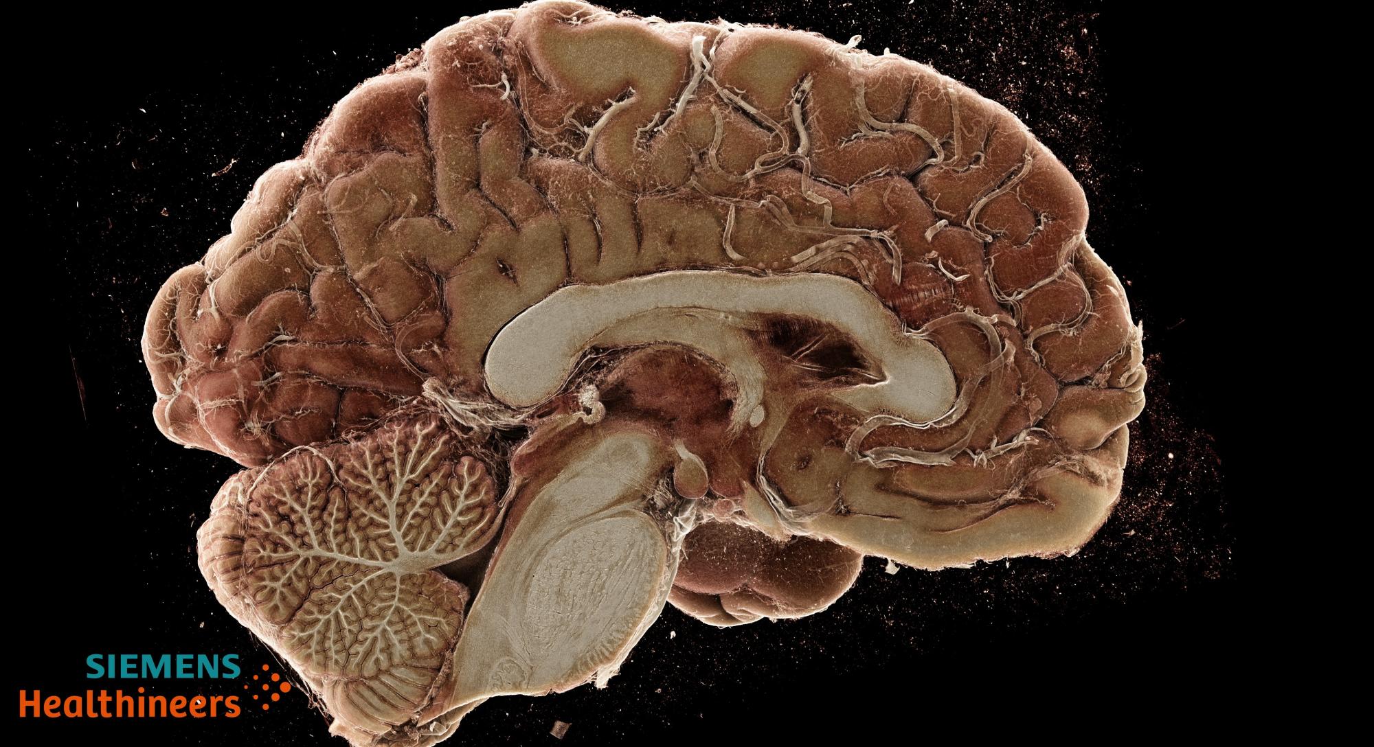 Ready for the new gold standard in human anatomy? - 3D Human Development